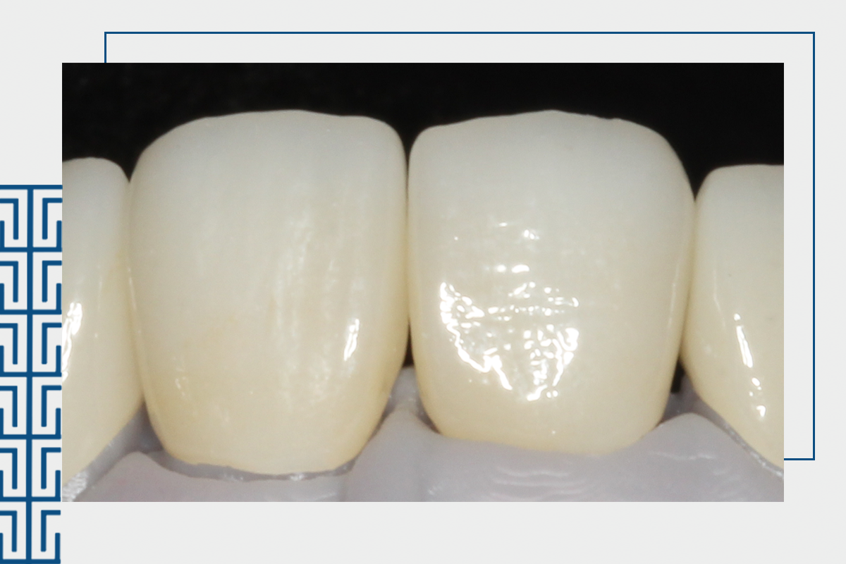 Como conseguir a Máxima Estética Dental para encantar seus pacientes ...
